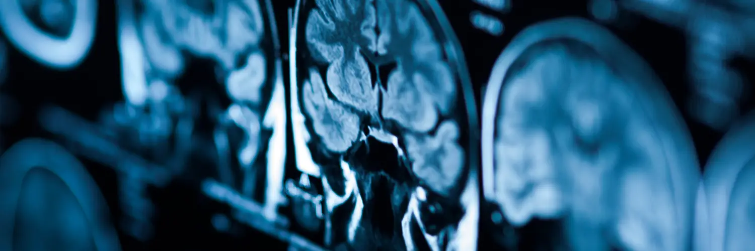 Brain Institute | Rice University